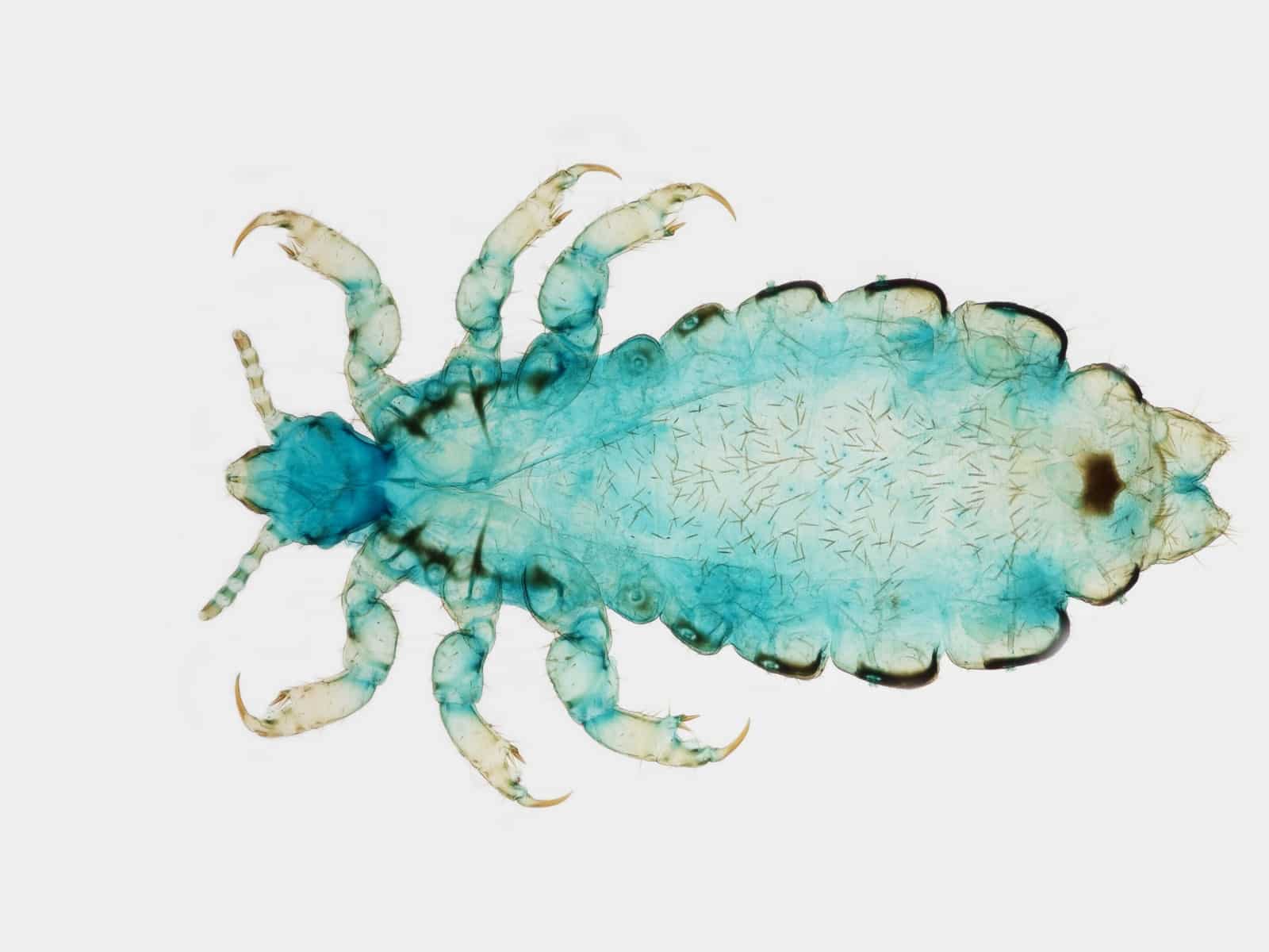 Se débarrasser des poux - Les pharma-formations de Mathilde